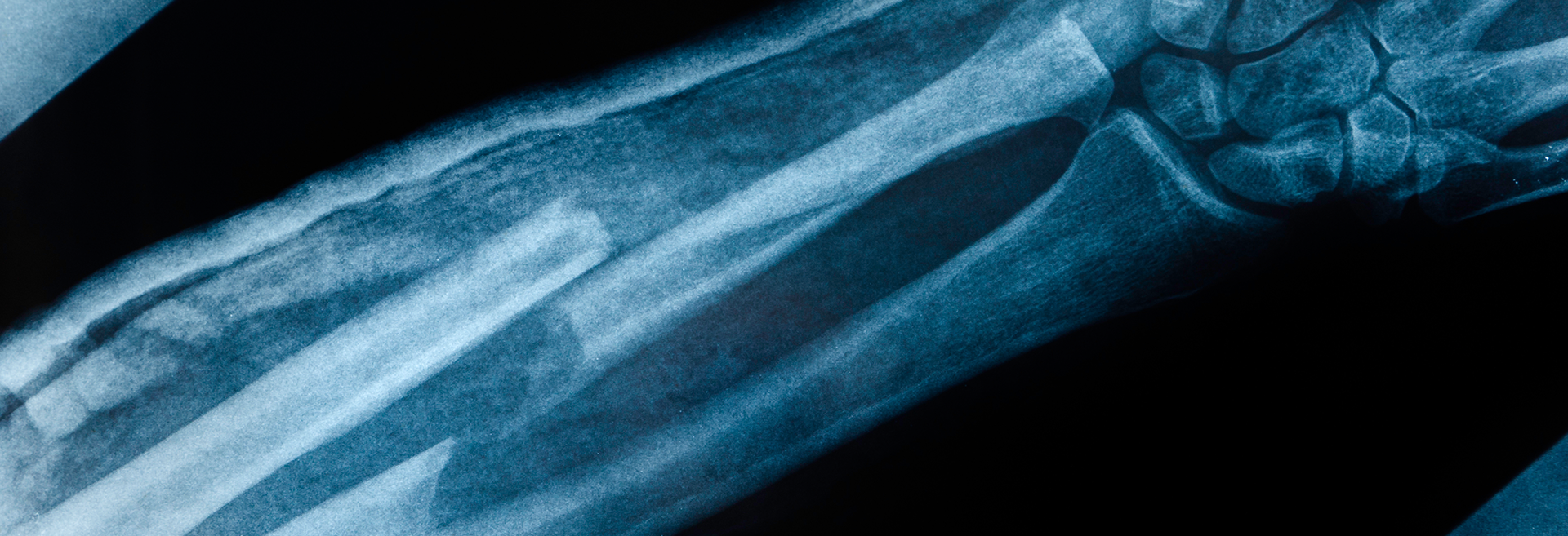 #1 Expertly Recognized Orthopedic and Fracture Clinic